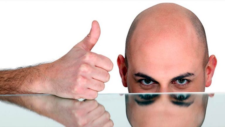 Los sorprendentes beneficios de quedarse calvo - INVDES