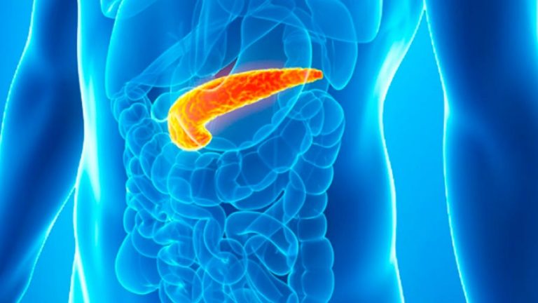 Descubierto un nuevo mecanismo alterado en cáncer de páncreas - INVDES