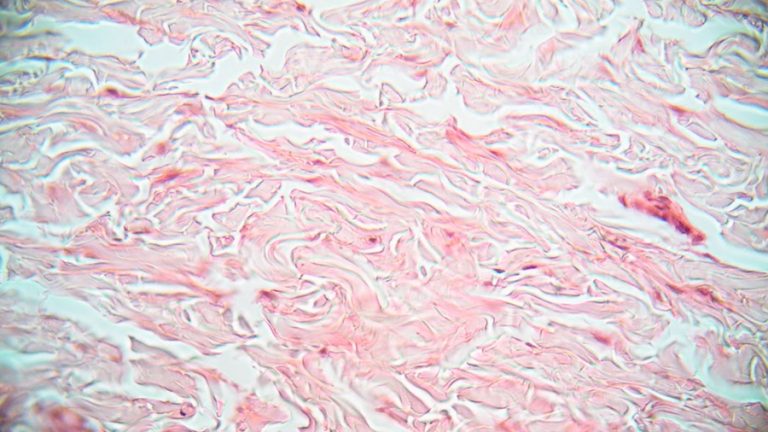 fibronectina archivos - INVDES