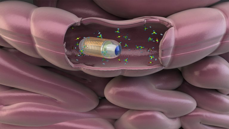 Una nueva pastilla capaz de recorrer el sistema digestivo - INVDES