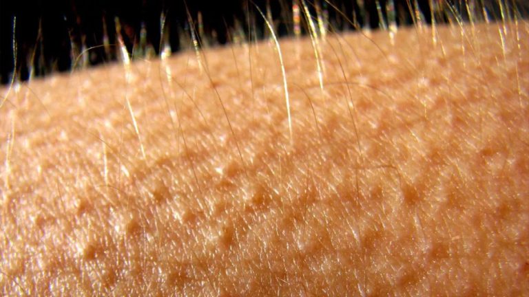 Logran crear por primera vez piel humana con capacidad para hacer ...